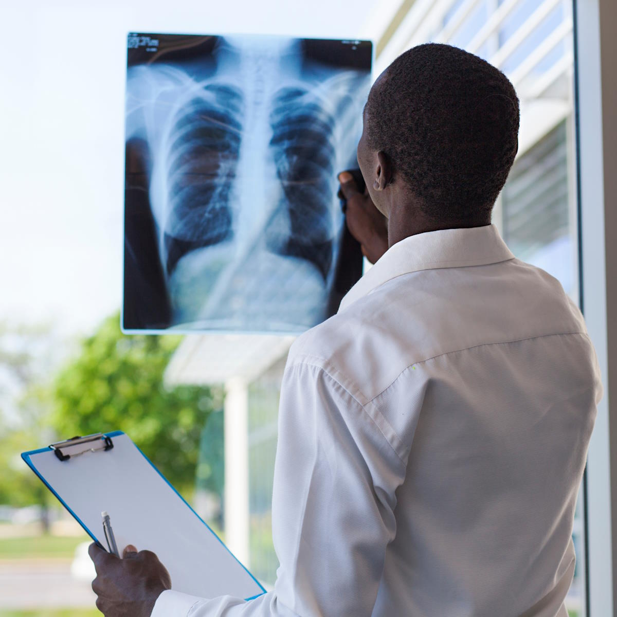 Embolie pulmonaire : cause, symptômes, traitement