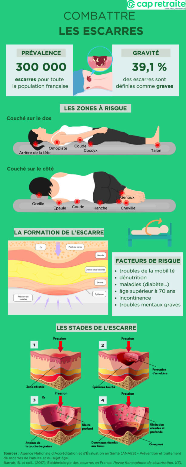 Tout sur l’escarre : définition, prévention, stades et traitement