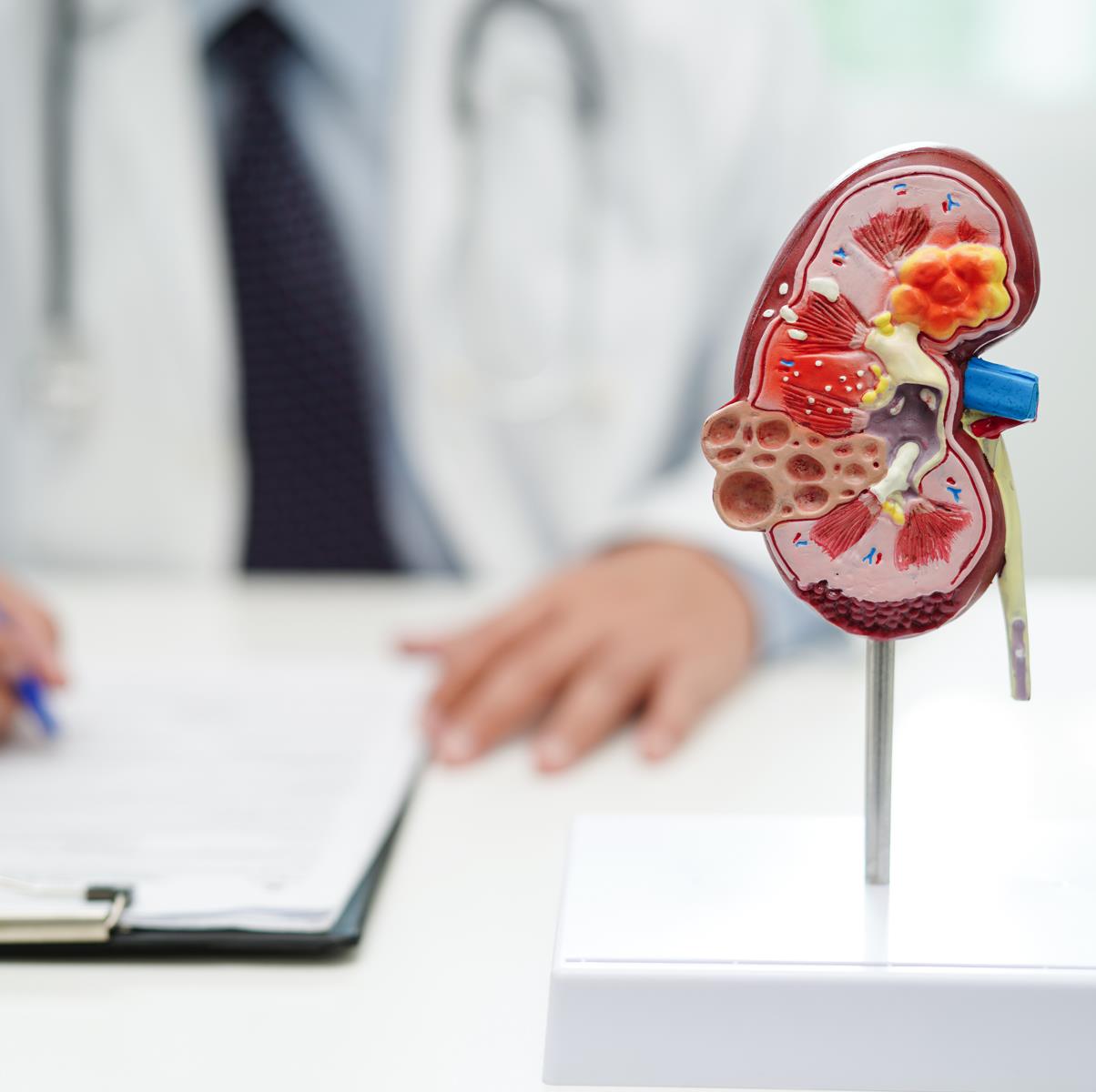 Tout sur la clairance de la créatinine : calcul et norme