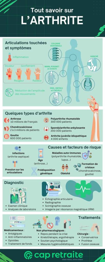 Arthrite : causes, types, symptômes et traitement